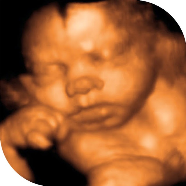 Diário de uma Mãe: Eco 3D-4D