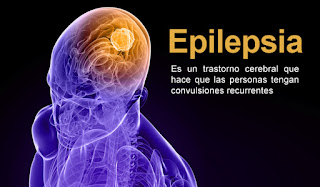 Novedades...: Epilepsia