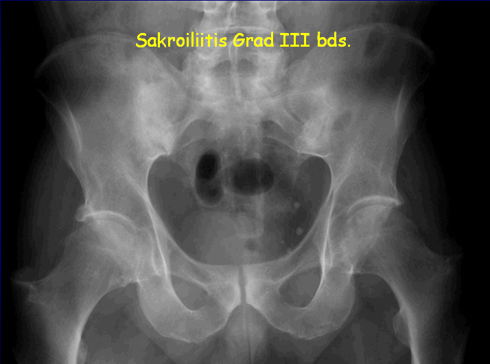 Rheumatologe: Verschiedene Schmerzarten in der Rheumatologie