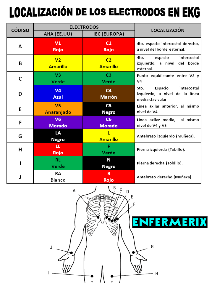 ENFERMERIX: ELECTROCARDIOGRAMA: LOCALIZACIÓN ANATÓMICA DE LOS ...