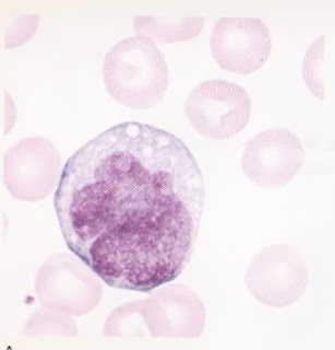 Hematología 2015