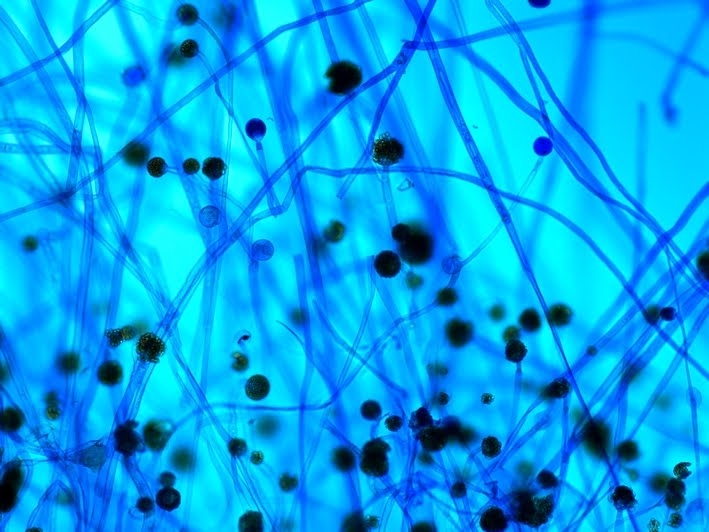 Fun With Microbiology (What's Buggin' You?): Mucor Species