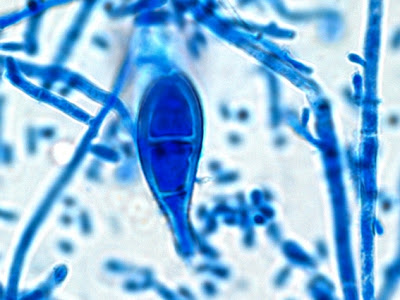 Fun With Microbiology (What's Buggin' You?): Microsporum audouinii