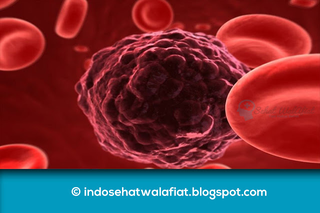 Cancer Causes and How to Treat It