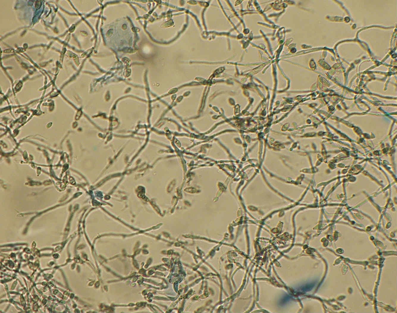 ATLAS MICOLOGIA: CLADOSPORIUM HERBARUM