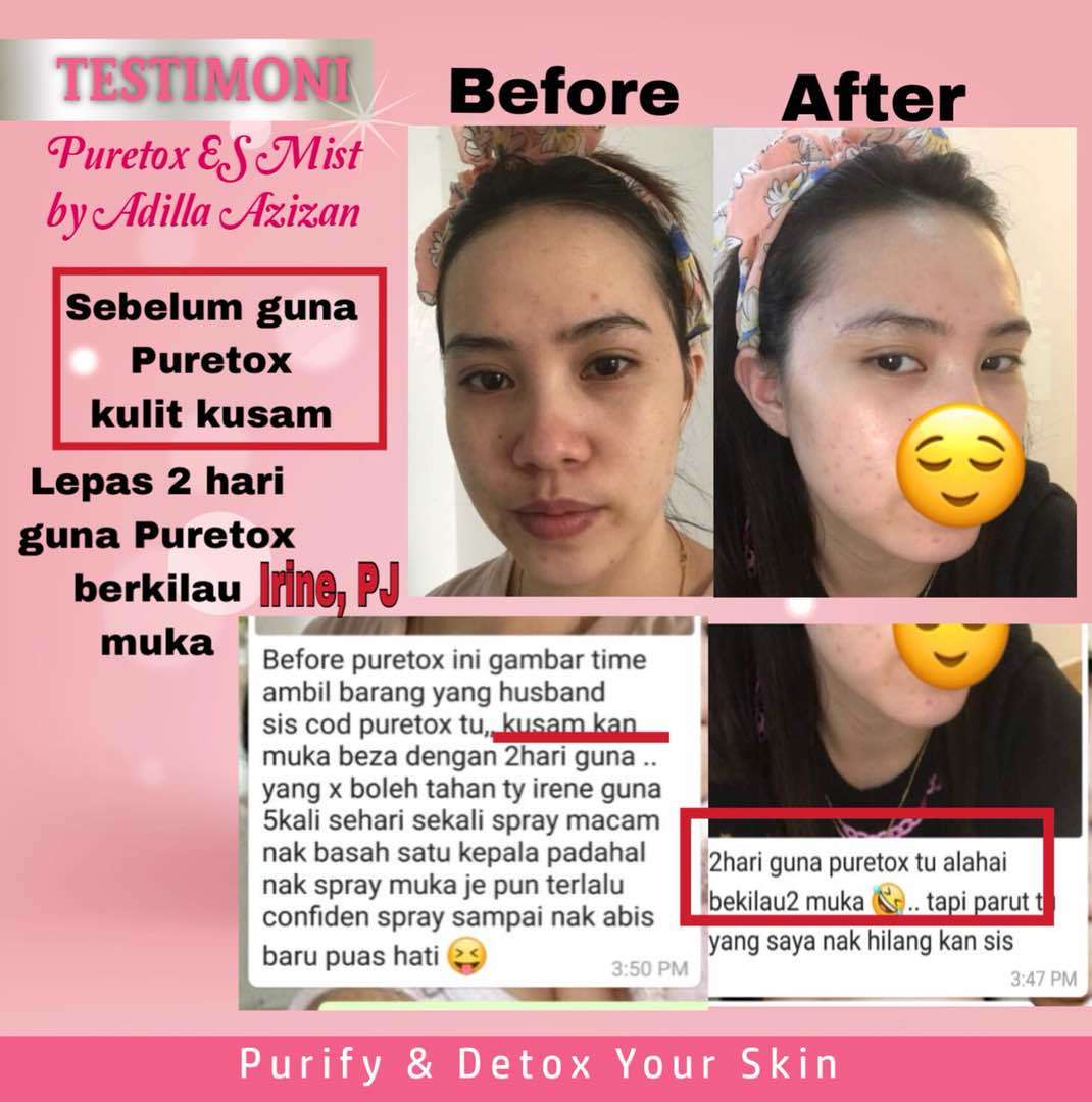PURETOX ES MIST by ADILLA AZIZAN ORIGINAL MURAH | Harga Murah Original ...