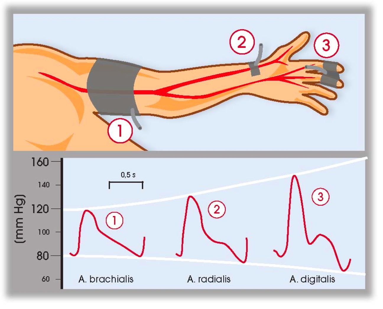 Arterial Line Arterial Line