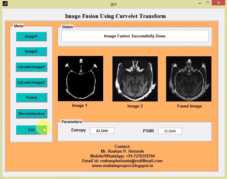 Image Fusion Using Curvelet Transform Matlab Project with Source Code ~ ENGINEERING PROJECTS