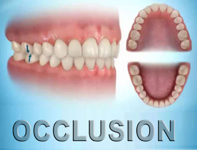 Notes for Dental Technicians: OCCLUSION OF TEETH