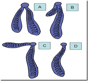 Genetika : Genom, Struktur Kromosom dan Genom Prokariotik dan Eukariotik