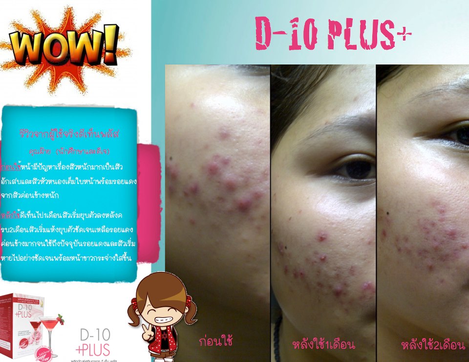 D10 plus หรือ D10 แจกฟรี ราคาส่งถูกที่สุด มีกำไรที่สุดรับตัวแทนจำหน่ายทุกคน