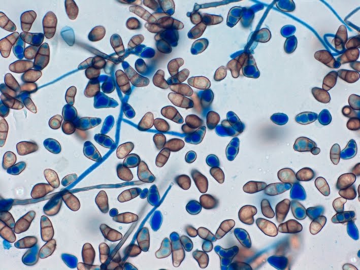 Fun With Microbiology (What's Buggin' You?): Curvularia sp.