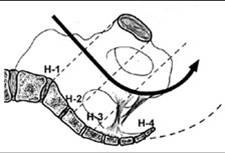 Bidan Thina: Bidang Hodge