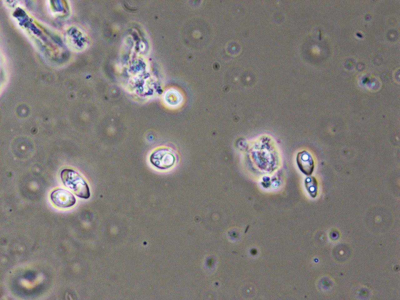 Bee Bugs: "Mystery Spores" in Bee Macerates