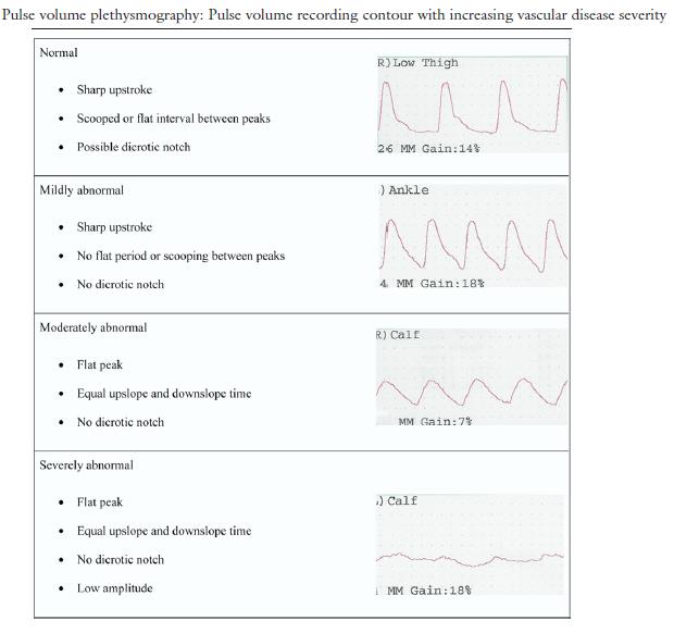 Vascular Mind : PULSE VOLUME RECORDING (PVR)