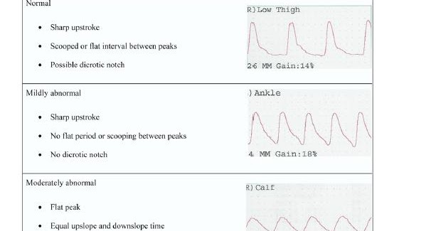Vascular Mind : PULSE VOLUME RECORDING (PVR)
