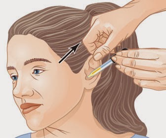 Administering Otic Medication ~ Nursing