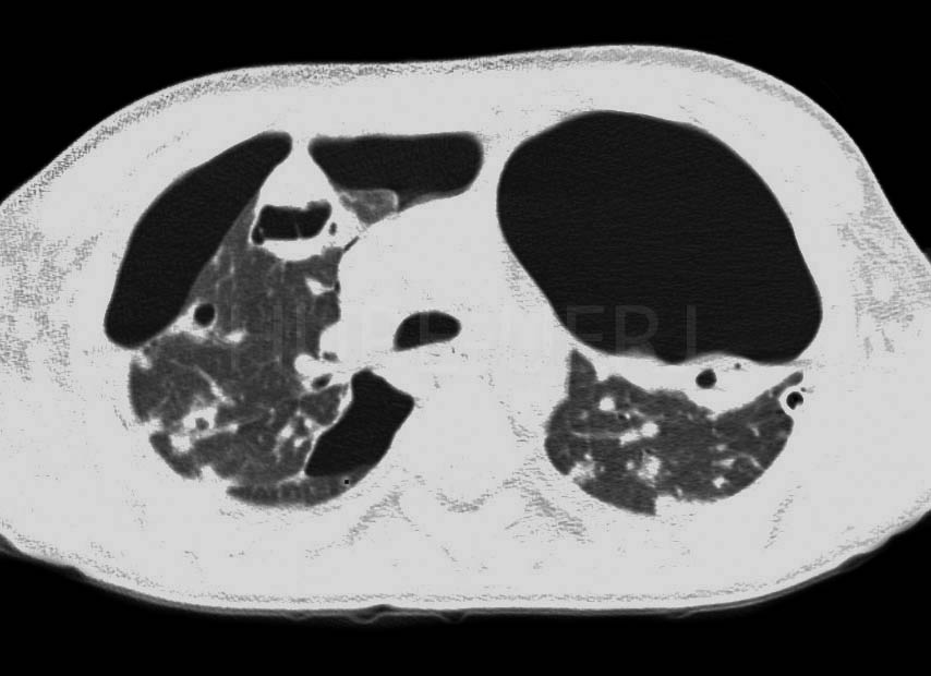 DISCIPLINA DE RADIOLOGIA DA UERJ NO FACEBOOK - Projeto de Extensão ...