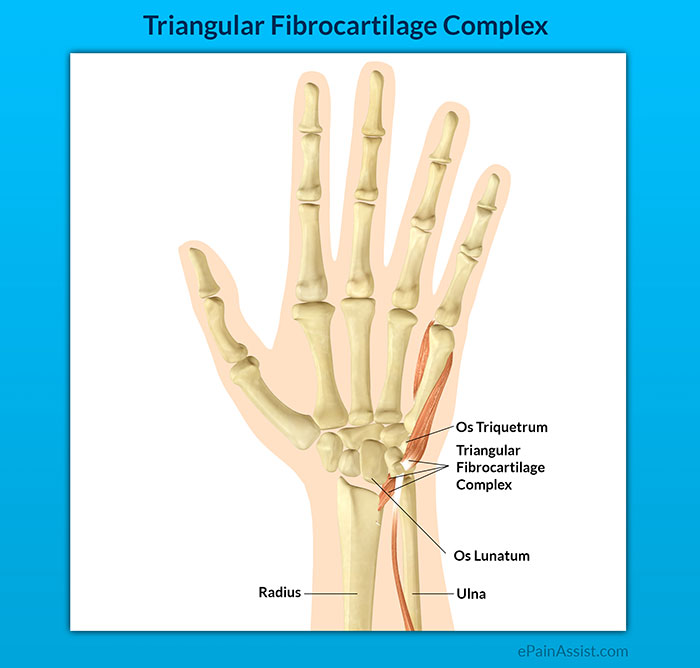 全家福祿壽: 【全】（懷疑）TFCC 受傷雜感