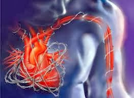 Infark Miocard Acut | GADAR