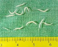 Pinworms and other parasites in humans: Protect children from pinworms
