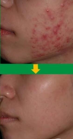 Skin: Here's the best way to solve it