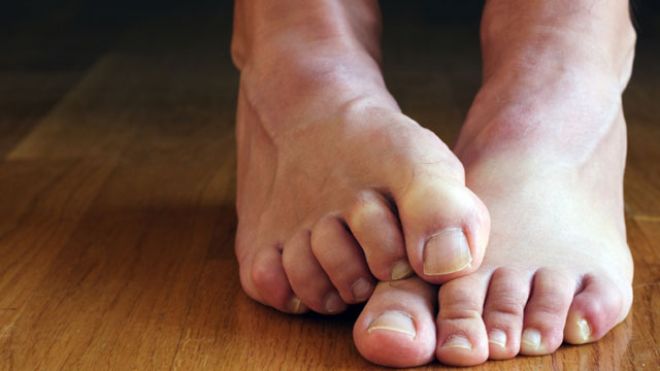 Tips to Prevent Leg Cramps in Toes | Daily Home and Family Tips