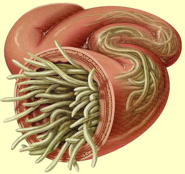 Neopentecostais são parasitas da sociedade? Dez exemplos