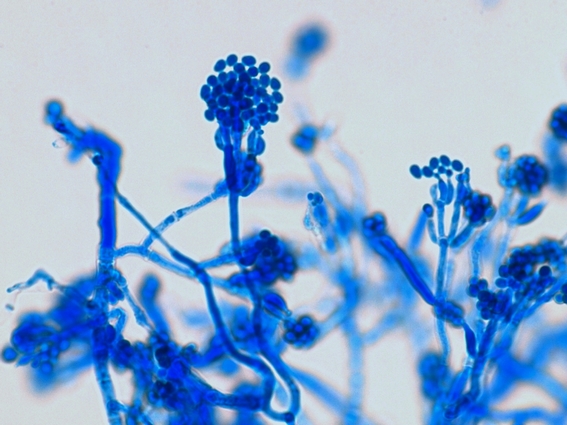 Fun With Microbiology (What's Buggin' You?): Gliocladium species