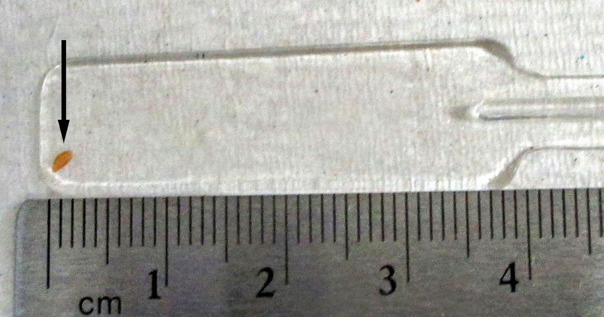 Creepy Dreadful Wonderful Parasites: Case of the Week 440