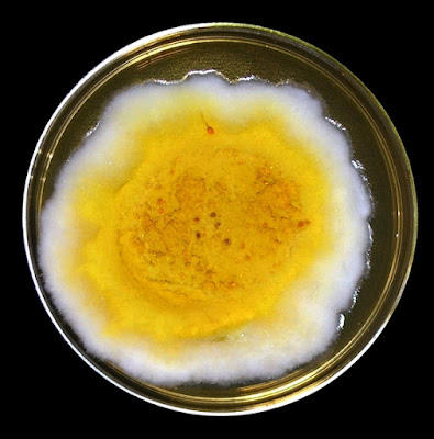 Fun With Microbiology (What's Buggin' You?): Sepedonium species