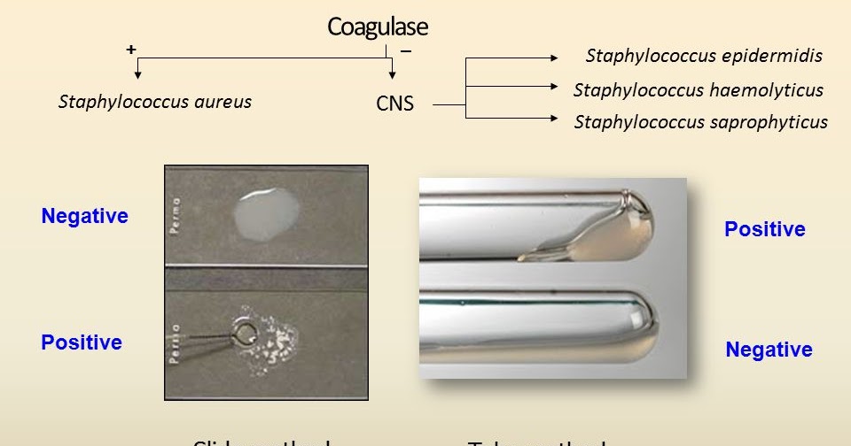 COAGULASE TEST - Microbiology Laboratory Turkey