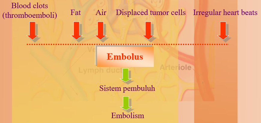 KNOWLEDGE: EMBOLUS
