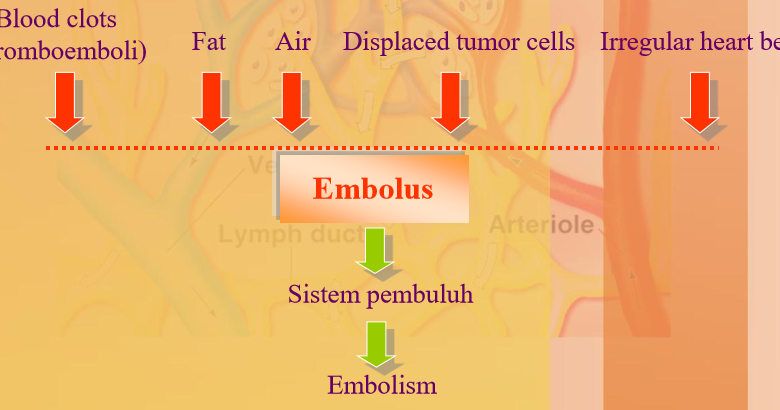 KNOWLEDGE: EMBOLUS