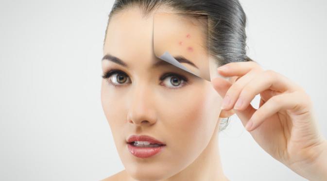 13 Langkah Mudah mencegah Jerawat dan Komedo - SIAP UJIAN