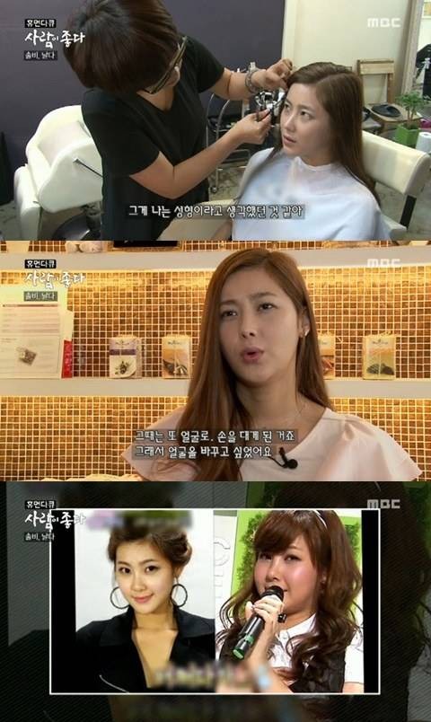 Oppa K-Pop: [News] Solbi Reveals She Thought Having Surgery would ...