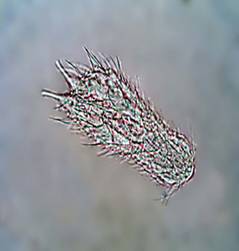 PHYLUM GASTROTRICHA