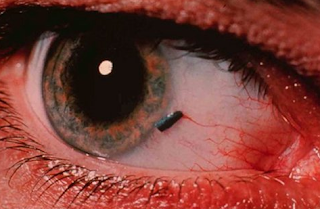 What To Do When You Get Something In Your Eye - Daily Health