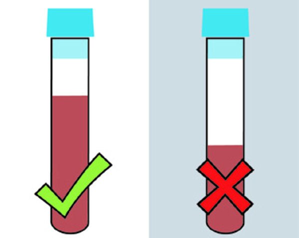 Medical Laboratory and Biomedical Science: Quality Improvement in the ...