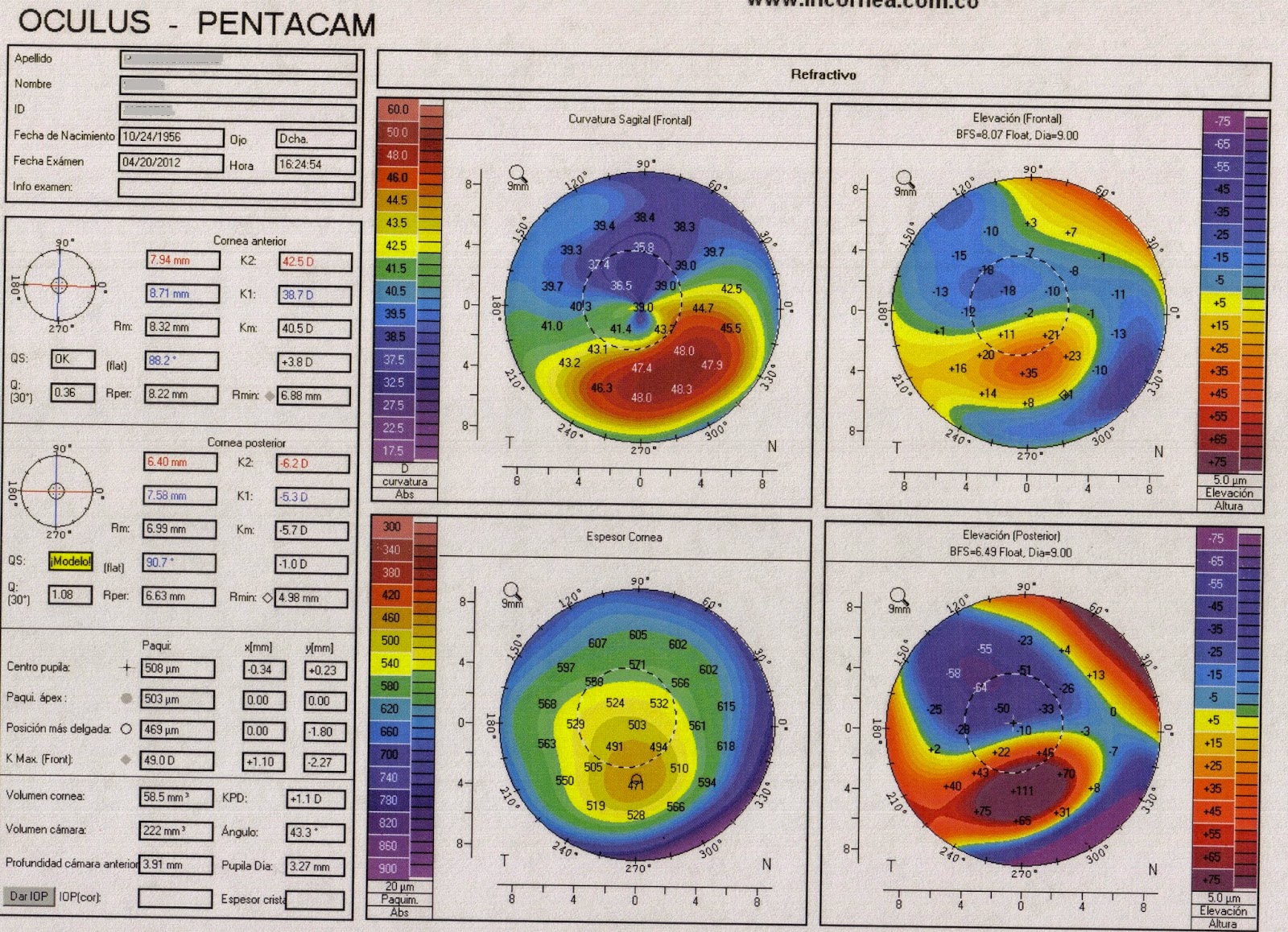 ADAPTACION DE LENTES EN PACIENTES CON QUERATOCONO Y POSTCIRUGIA ...