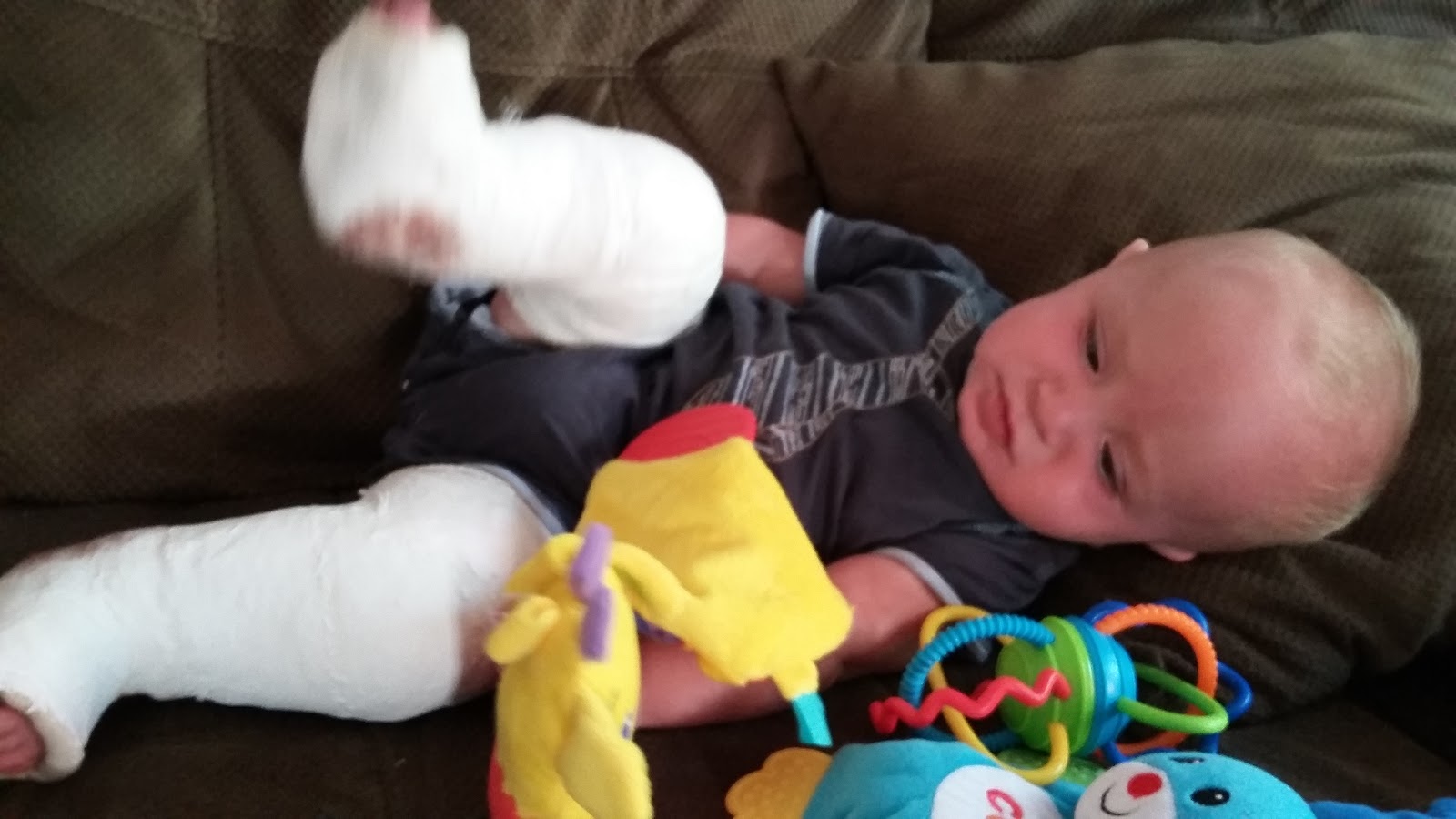 Andrew, Jonathan & Alexander: Baby with Casts