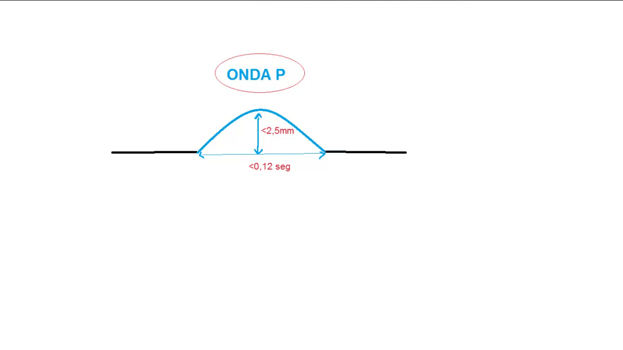 ECG normal (12): Onda P (duración, voltaje y morfología) - Dr. Alberto ...