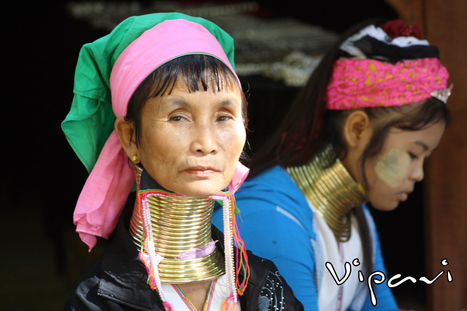 La realidad de las mujeres jirafa - Vipavi