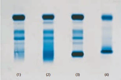 Multiple Myeloma and Related Conditions | Tuyenlab
