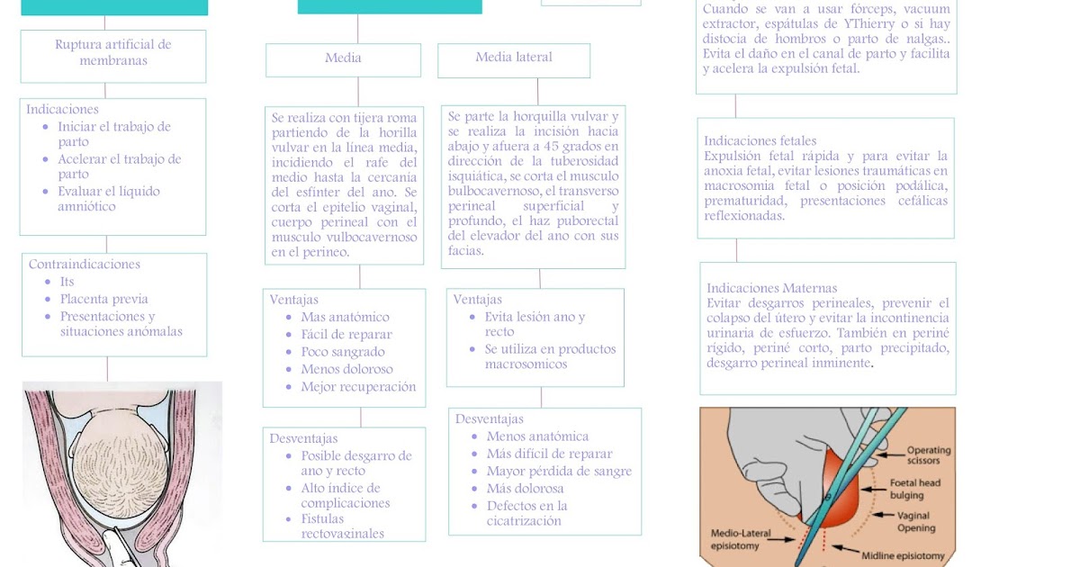 Amniorrexis y episiotomia
