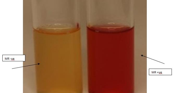 Protocol for MR/VP tests ~ Dhiraj's Blog