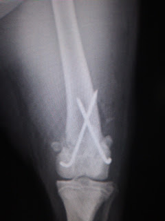 Traumatologia y Cirugia Ortopedica Veterinaria: FRACTURA DISTAL DE ...