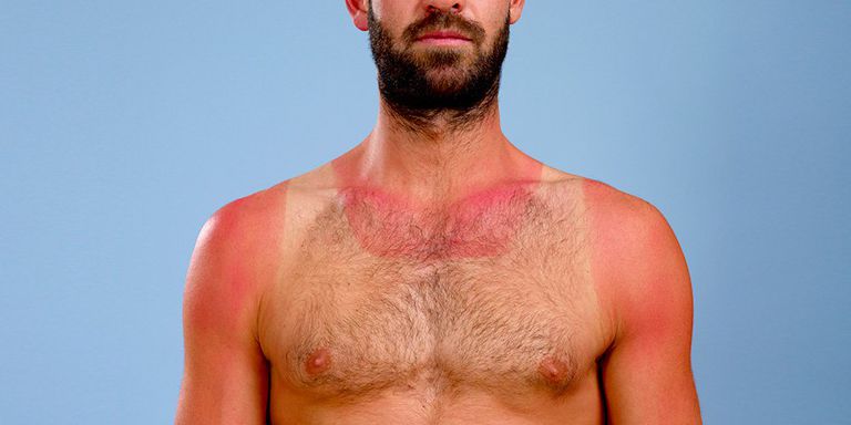 10 Reasons Why Summer is the Worst Season - GREEN BEANS