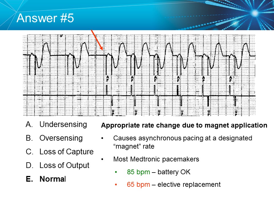 CVT Mohd Farid: Basic Pacemaker Troubleshooting Part II-Medtronic Academy