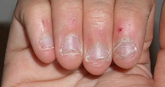 iCuriosity: Ways to Quit a Bad Habit